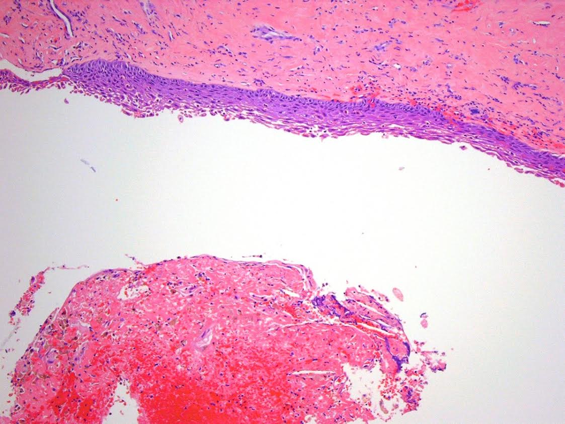 Interesting Oral Pathology Case | Dr. Dmitry Tsvetov