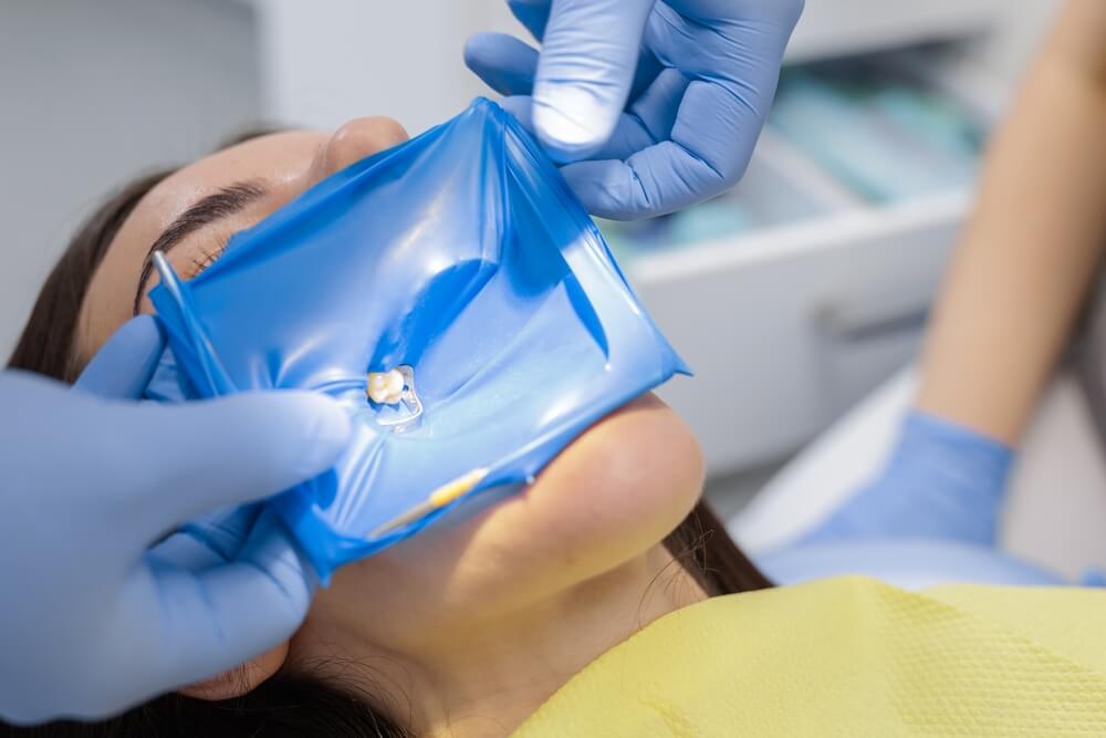 Guide to Premolar Orthodontic Extractions in Murrieta